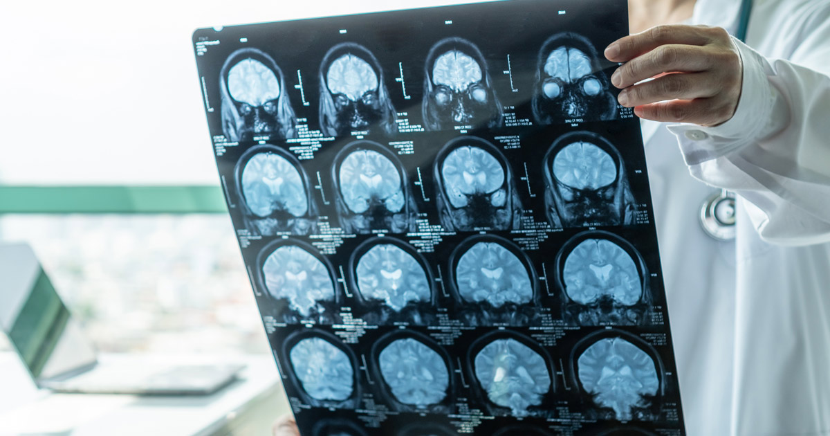 New Jersey Brain Injury Lawyer | Pietras Saracino Smith & Meeks