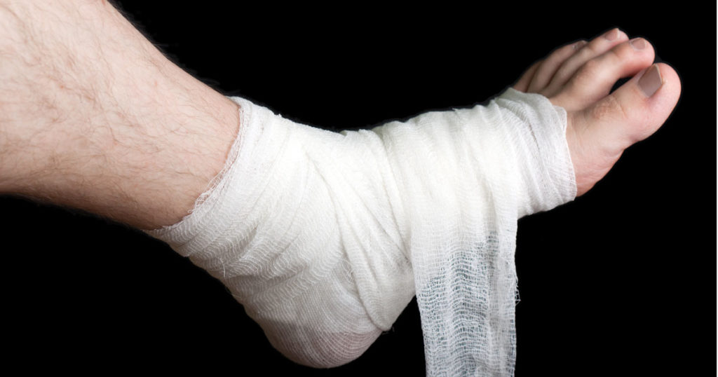 What Are Common Types of Foot Injuries in the Workplace?